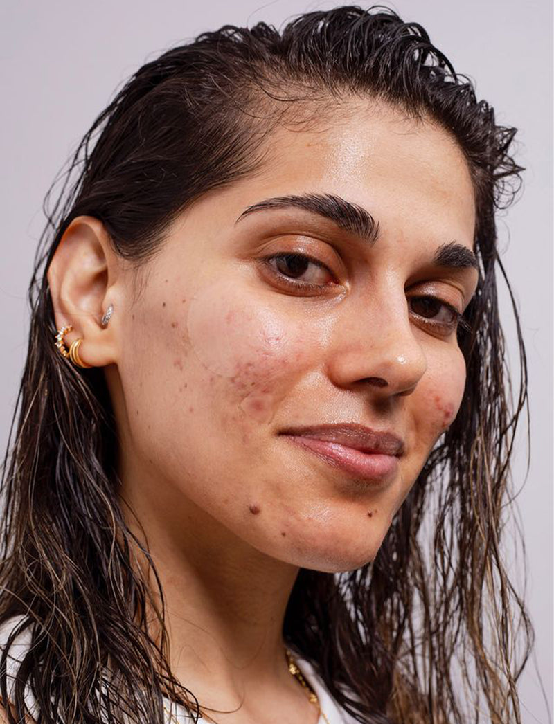 Common Clouds Cloud Patch | Korelu