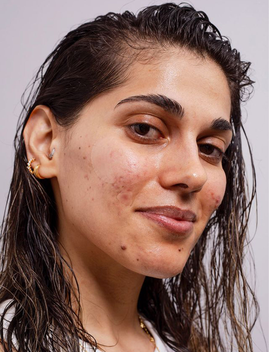 Common Clouds Cloud Patch Korelu